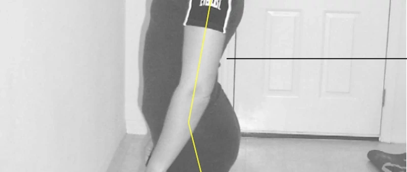 Hilfe, ein Hohlkreuz! - Faszientherapie in Quedlinburg